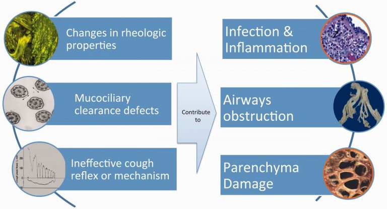 High Frequency Chest Wall Oscillation (HFCWO) – Hayek Medical